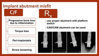Implant failure & its management.pptx