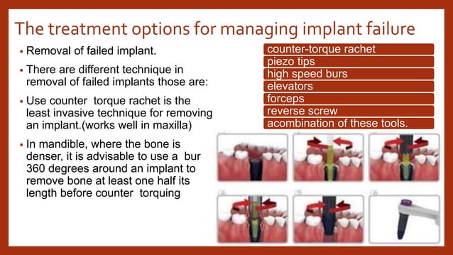Implant failure & its management.pptx