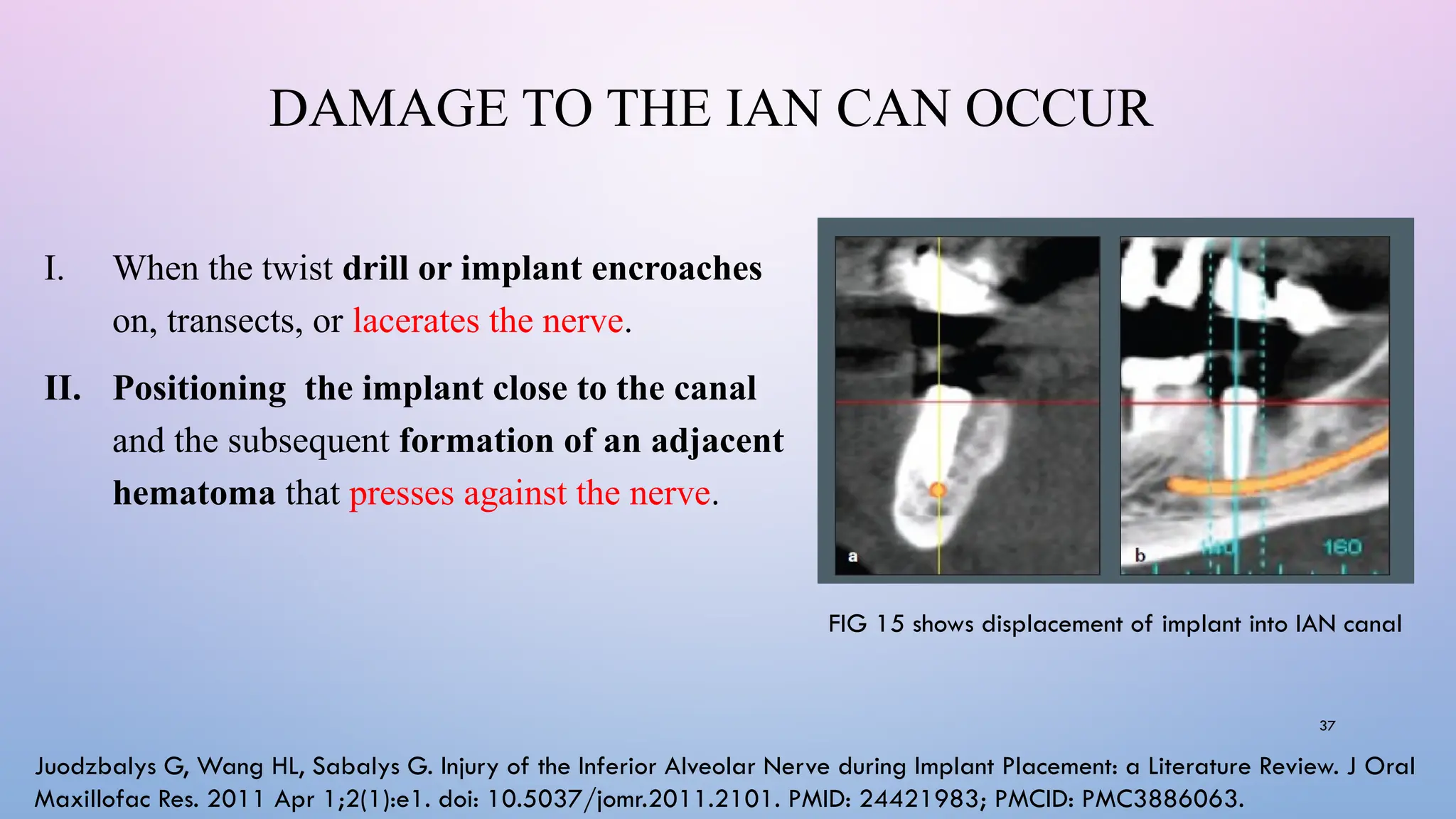 Implant failure & its management (Final).pptx