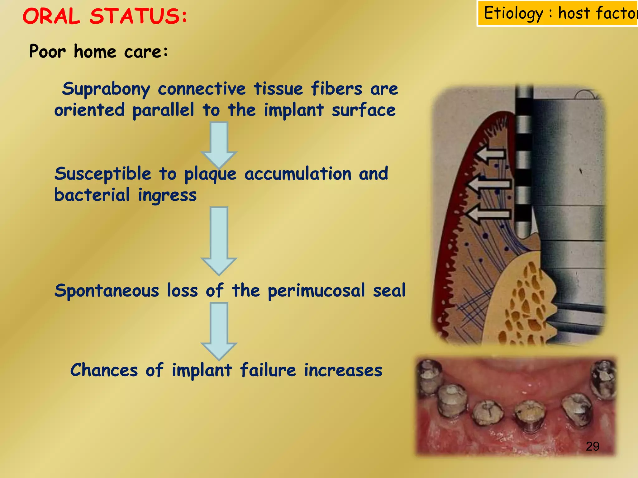 Implant failure | PPTX