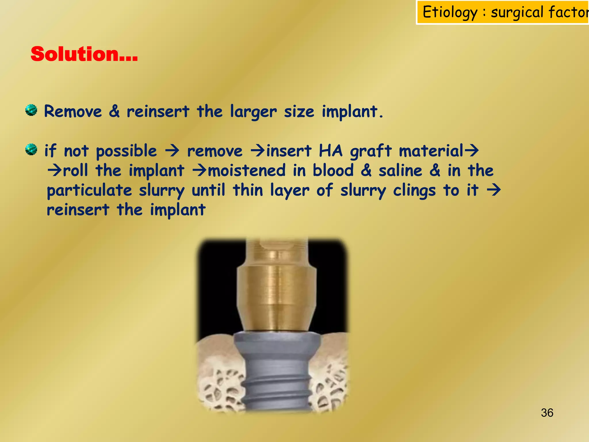 Implant failure | PPTX