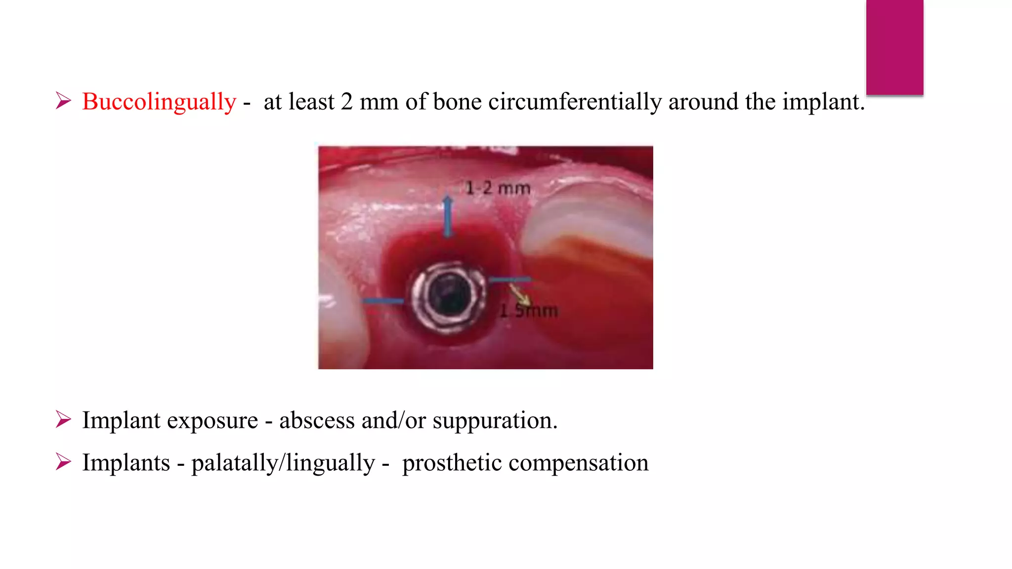 Implant Complications and Failures | PPTX