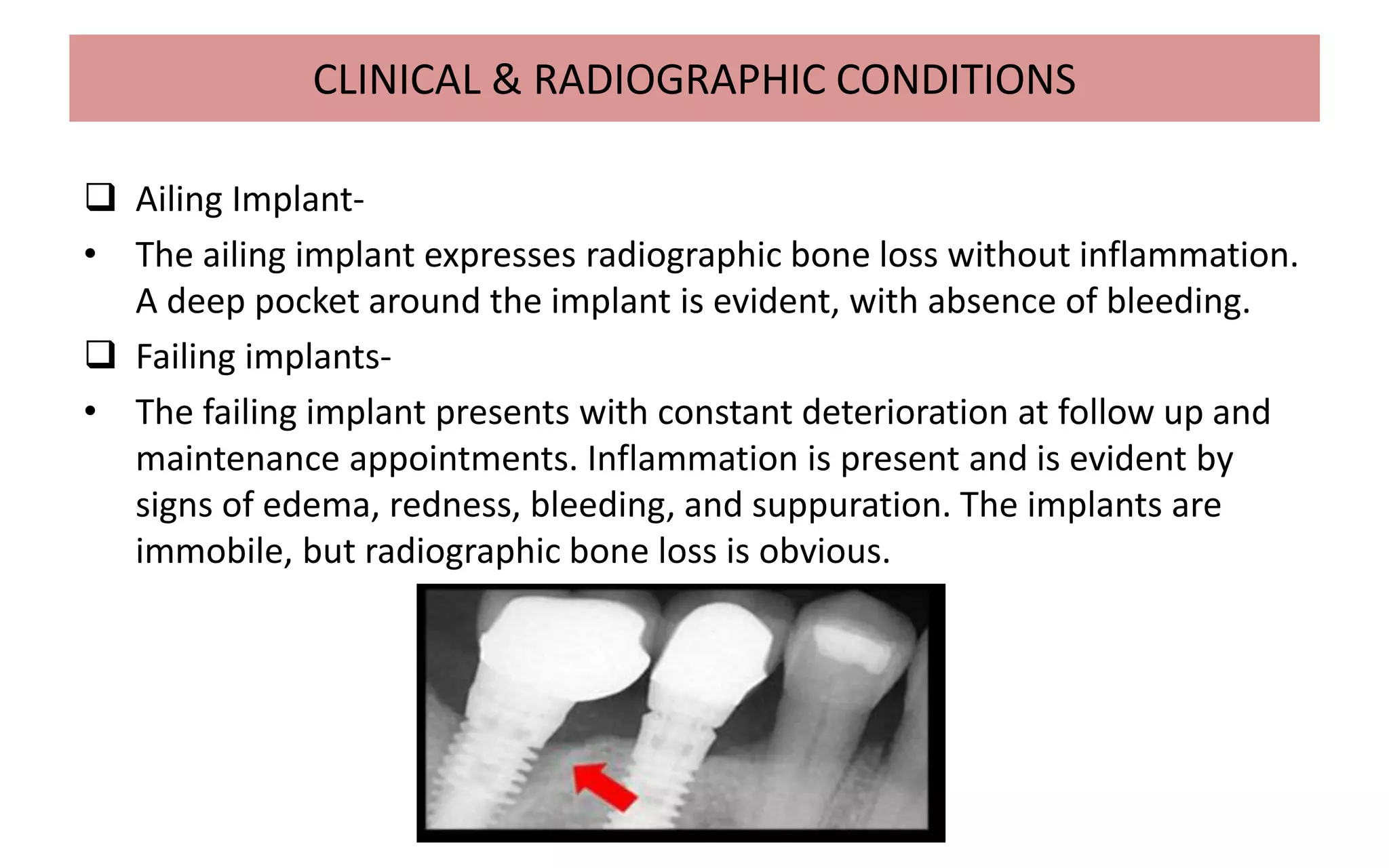 Implant failure , complications and treatment, management- Partha ...