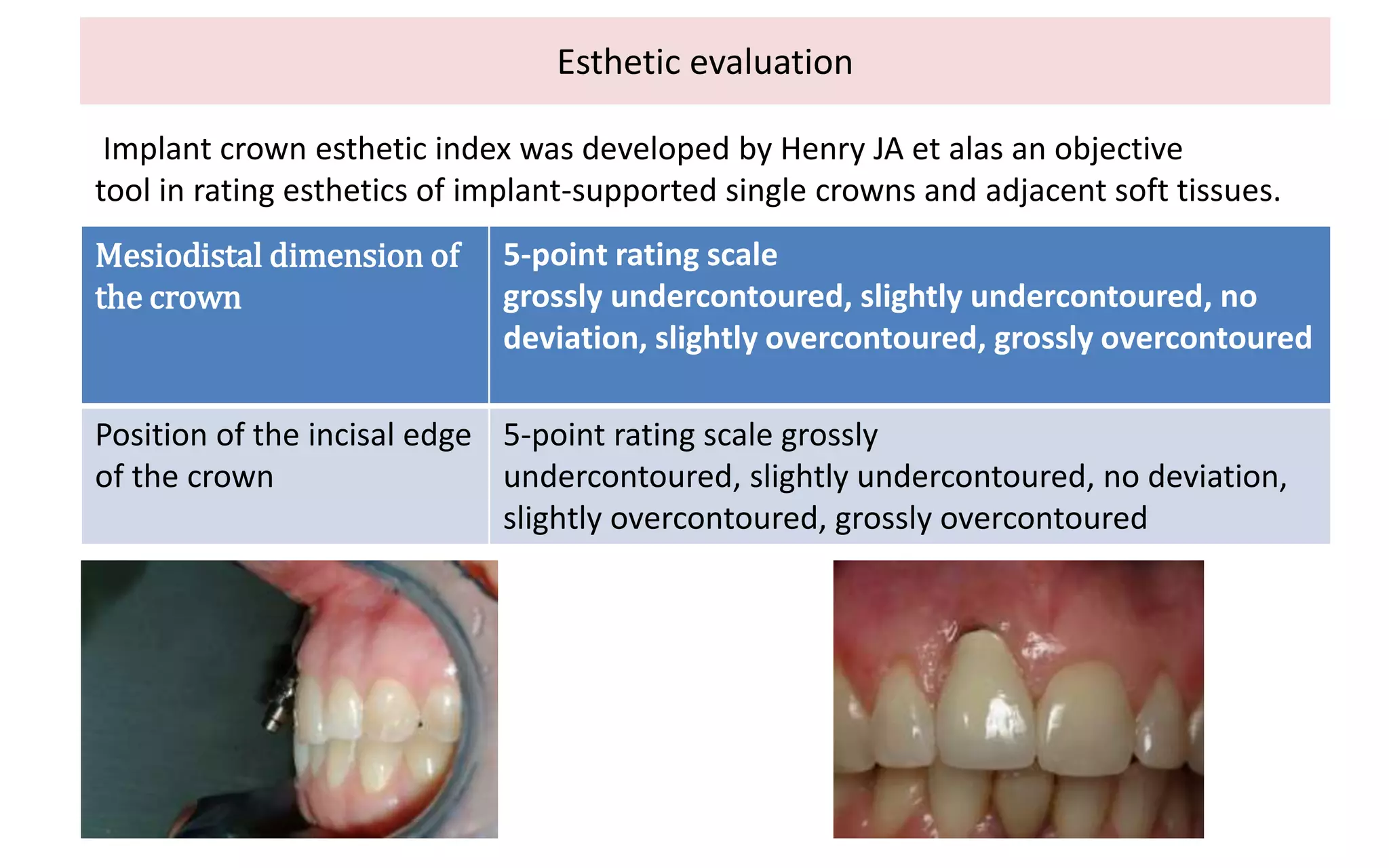 Implant failure , complications and treatment, management- Partha ...