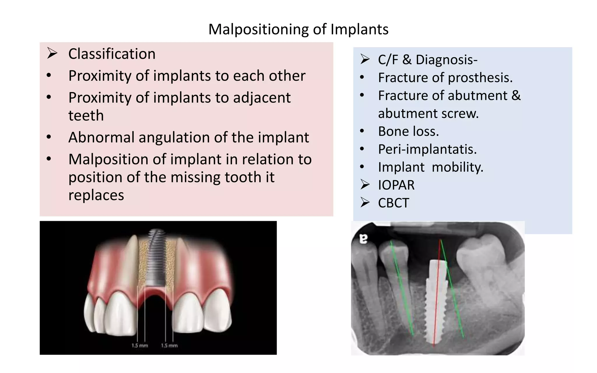 Implant failure , complications and treatment, management- Partha ...