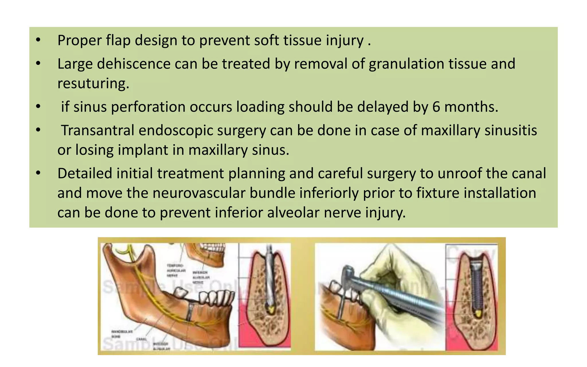 Implant failure , complications and treatment, management- Partha ...