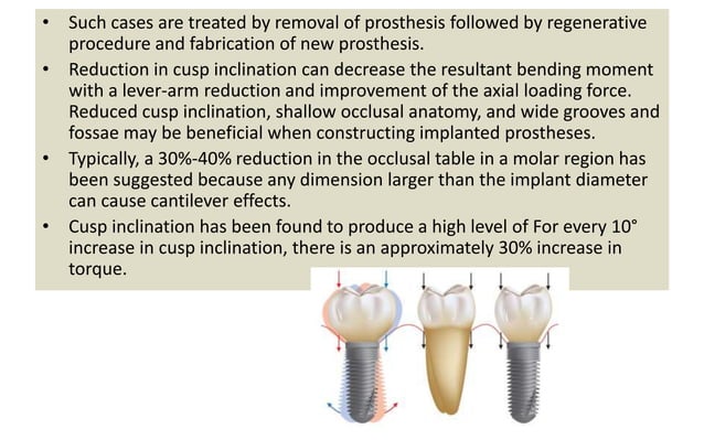 Implant failure , complications and treatment, management- Partha ...