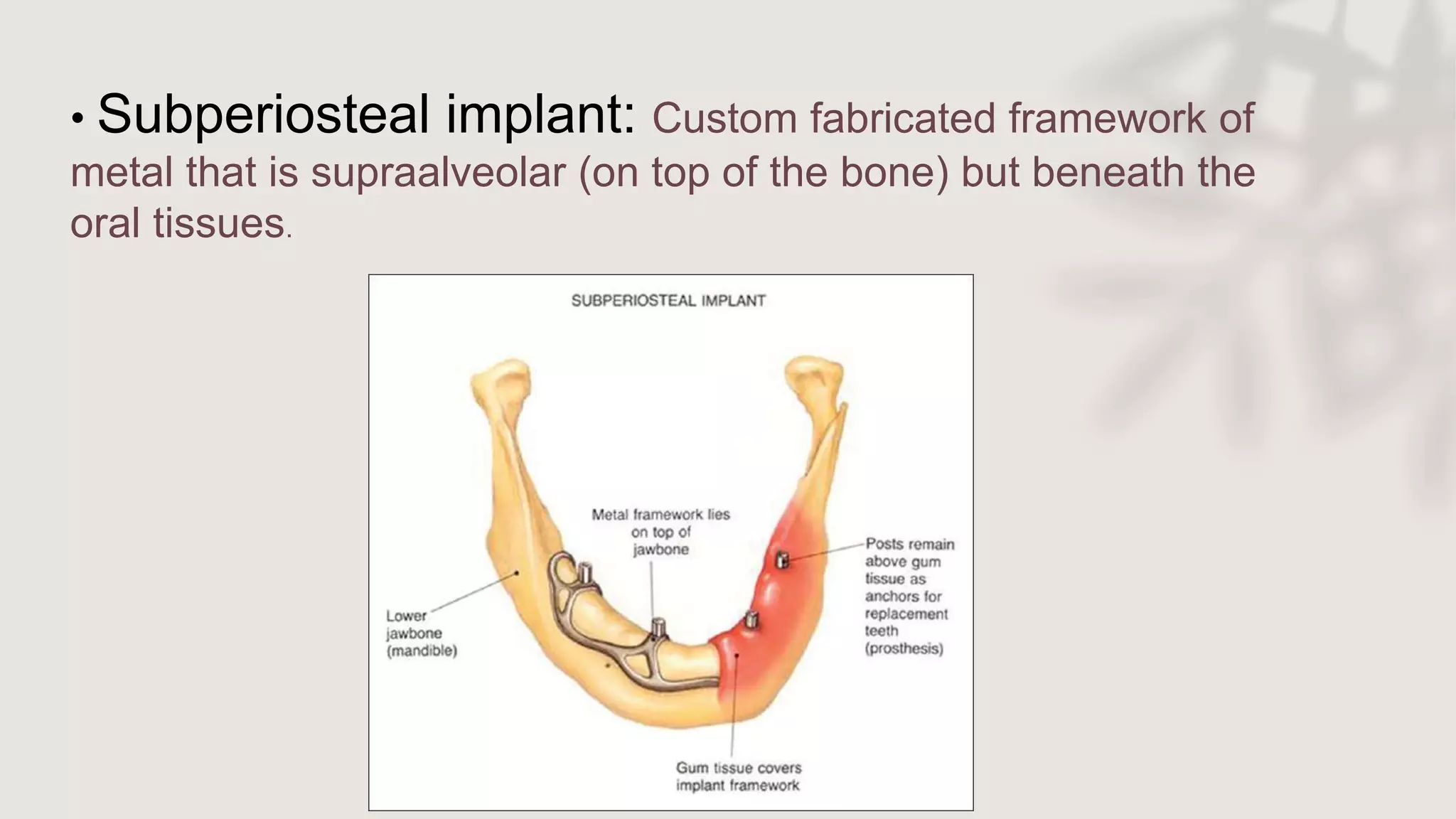 IMPLANTS | PPTX