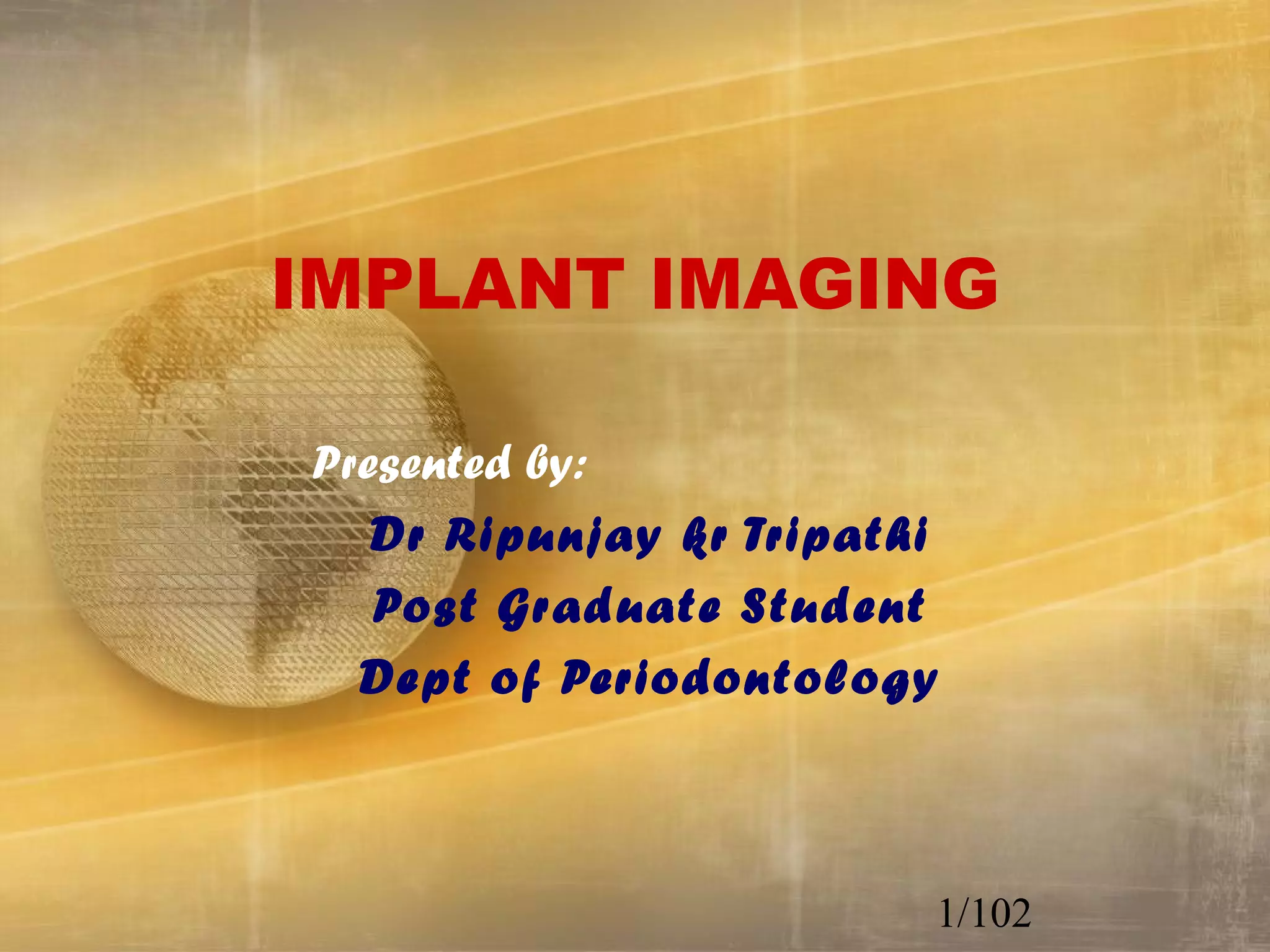 IMPLANT IMAGING TECHNIQUE | PPT