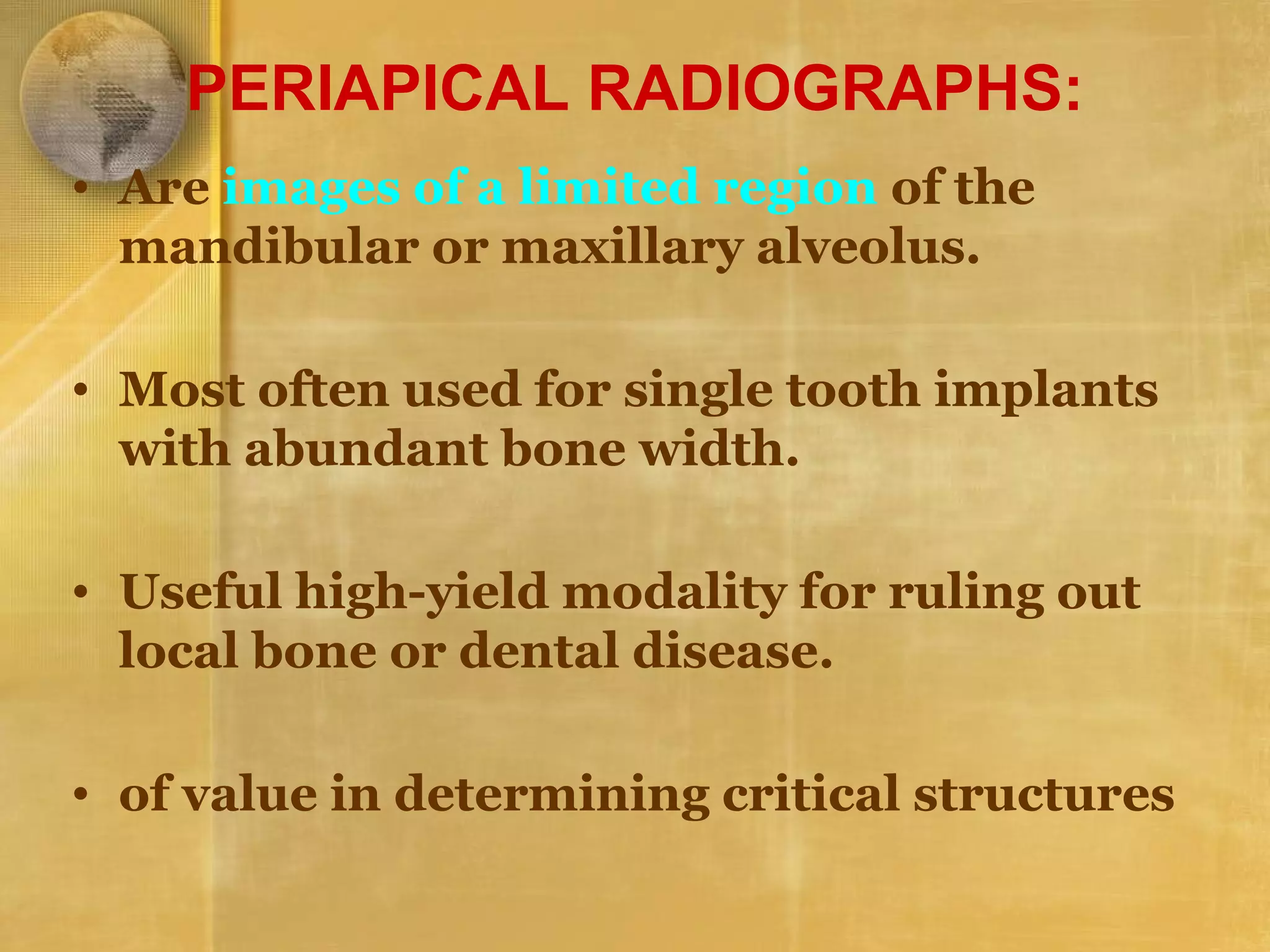 IMPLANT IMAGING TECHNIQUE | PPT