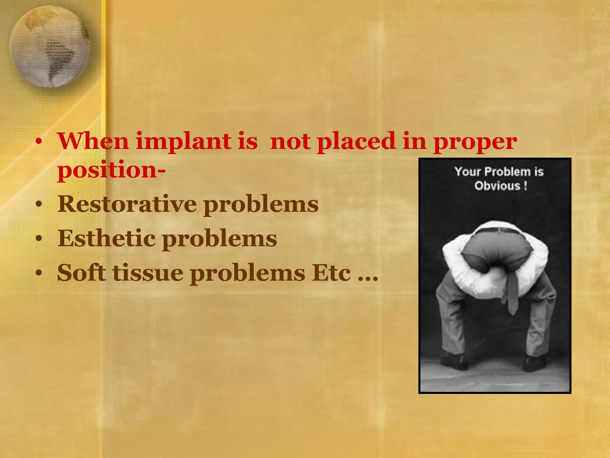 IMPLANT IMAGING TECHNIQUE | PPT