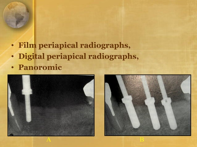 IMPLANT IMAGING TECHNIQUE | PPT | Dental Health | Diseases and Conditions