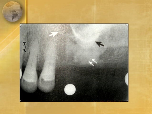 IMPLANT IMAGING TECHNIQUE | PPT | Dental Health | Diseases and Conditions