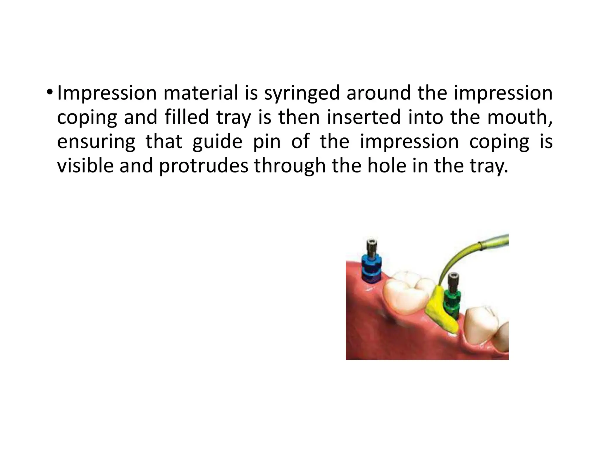 different implant impression techniques.pptx