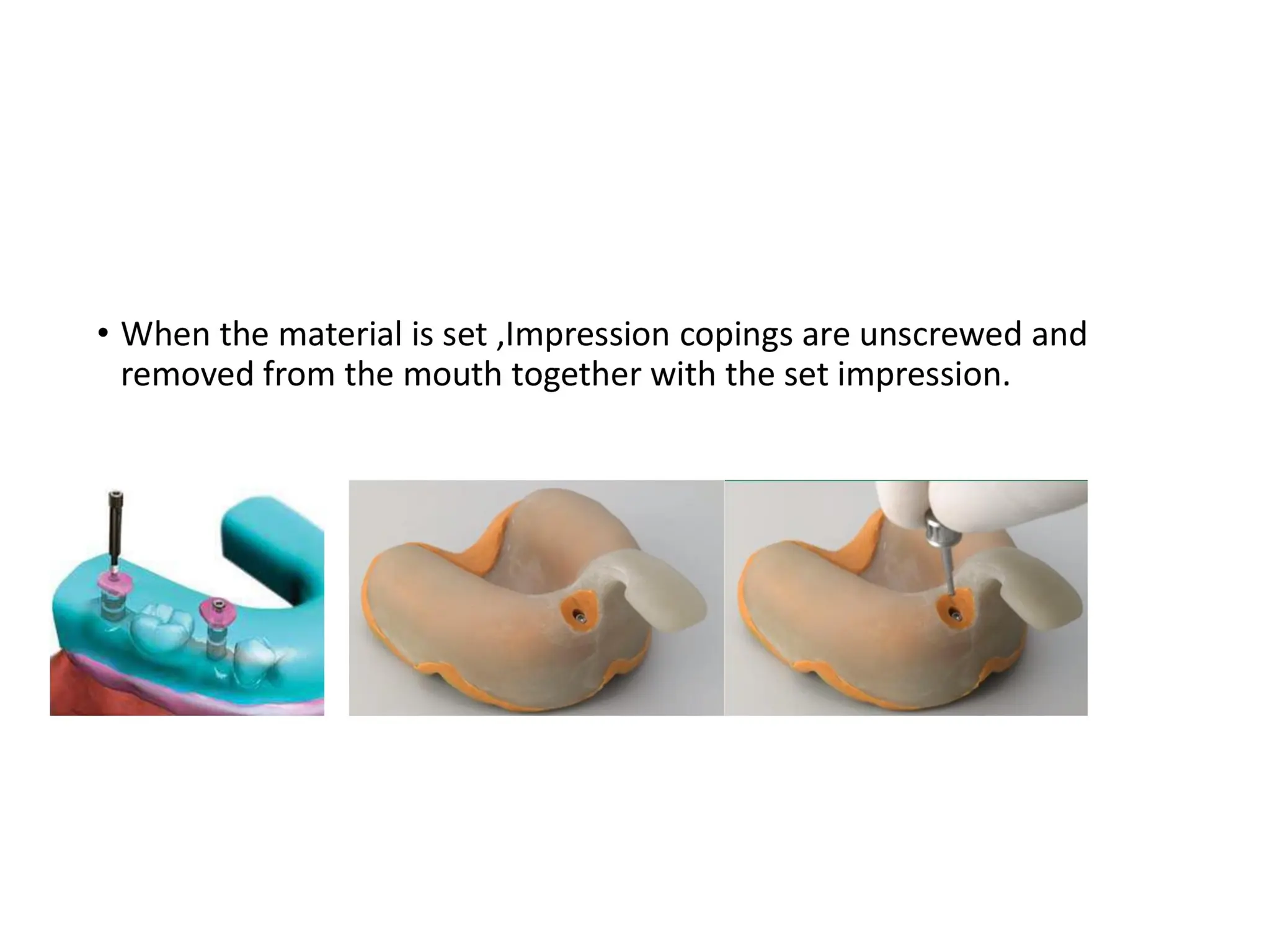 different implant impression techniques.pptx
