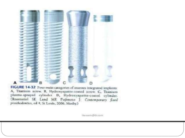 Peri Implant Anatomy, Function and Biology | PPTX