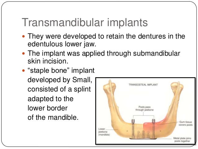 Peri Implant Anatomy, Function and Biology