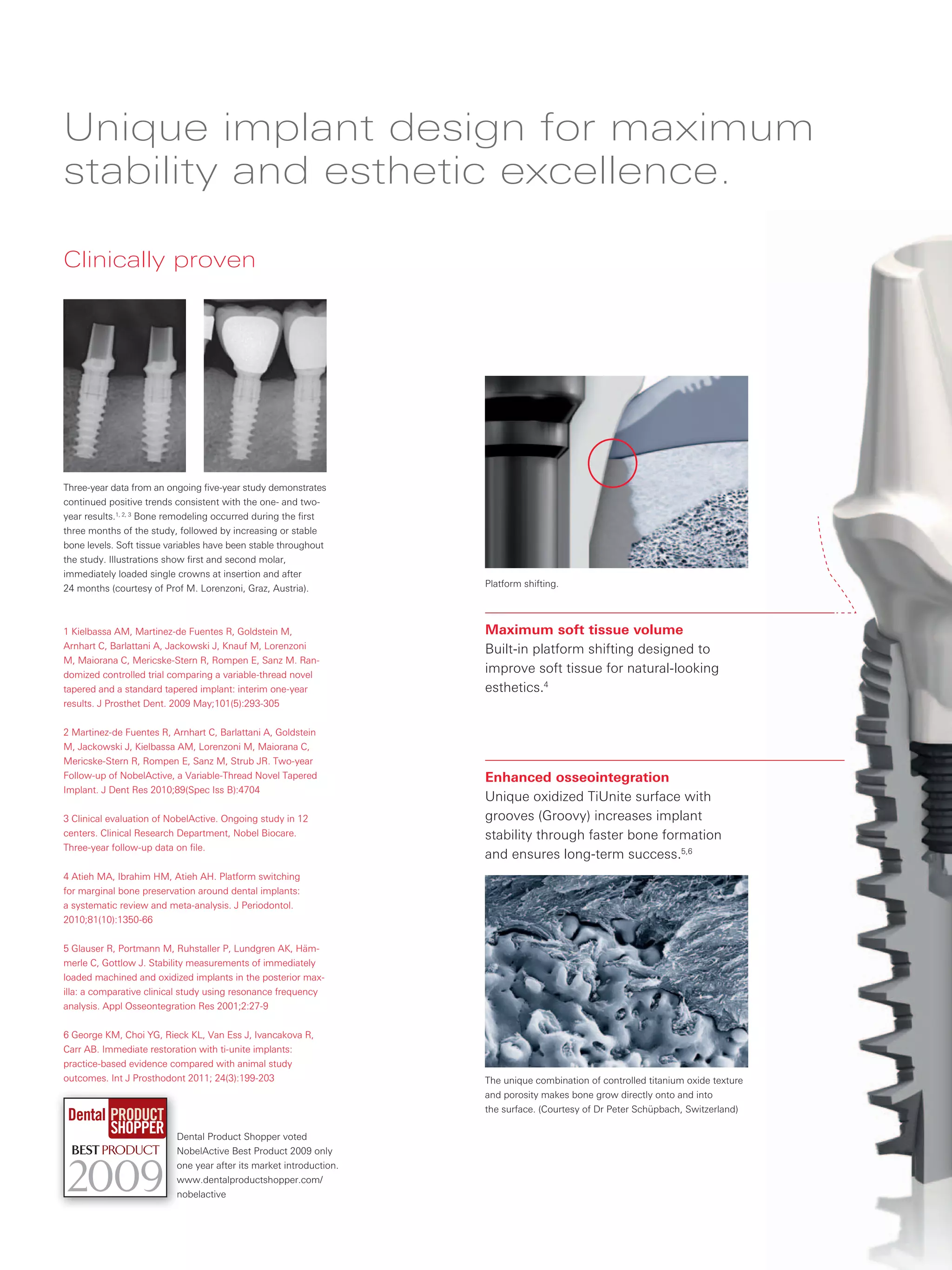 Dental Implant like no other | PDF