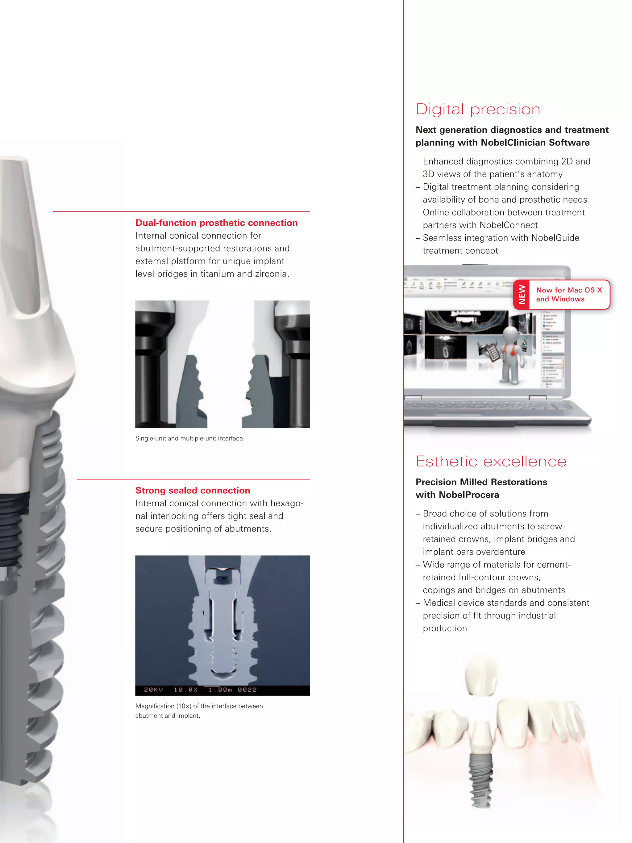Dental Implant like no other | PDF