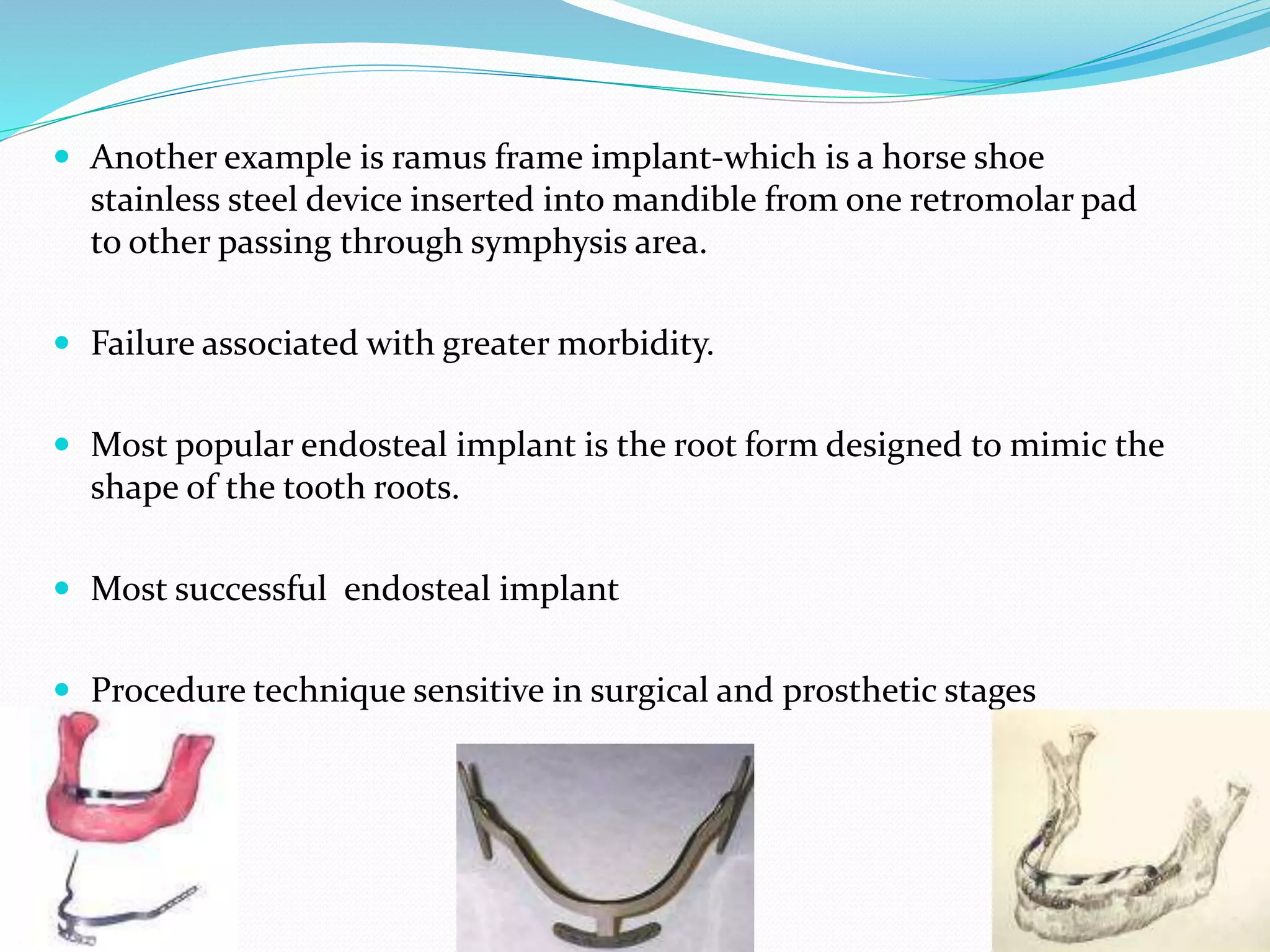 Implant materials | PPTX