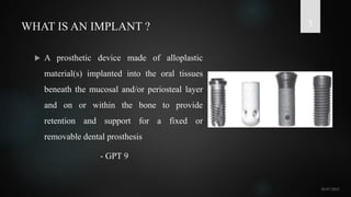 Implant Materials | PPTX