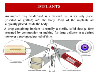 Implant medical devices.pptx