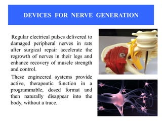 Implant medical devices.pptx