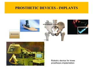 Implant medical devices for pharmaceuticals | PPTX