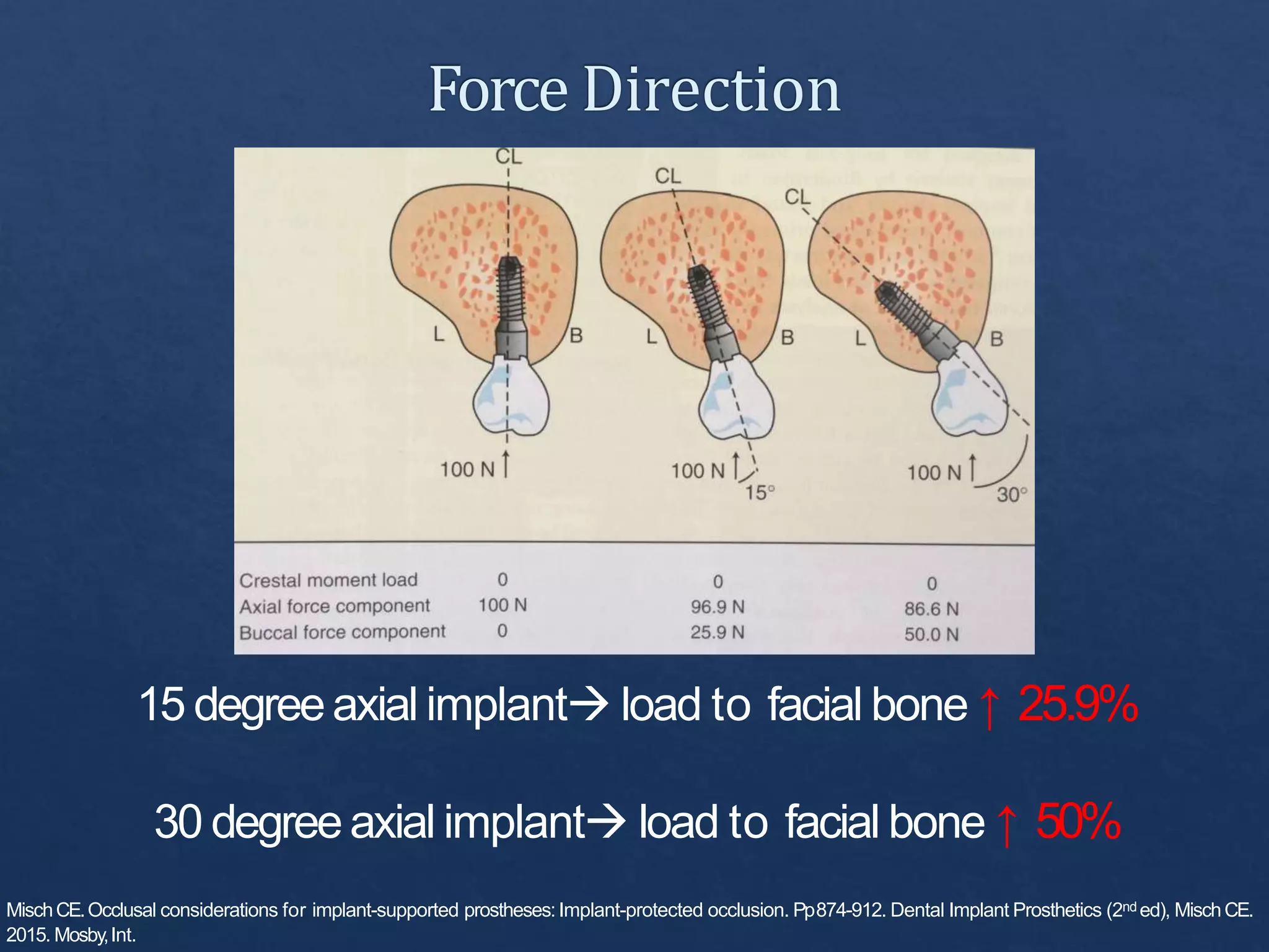 Implant Occlusion.pptx
