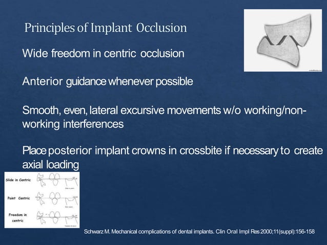 Implant Occlusion.pptx | Dental Health | Diseases and Conditions