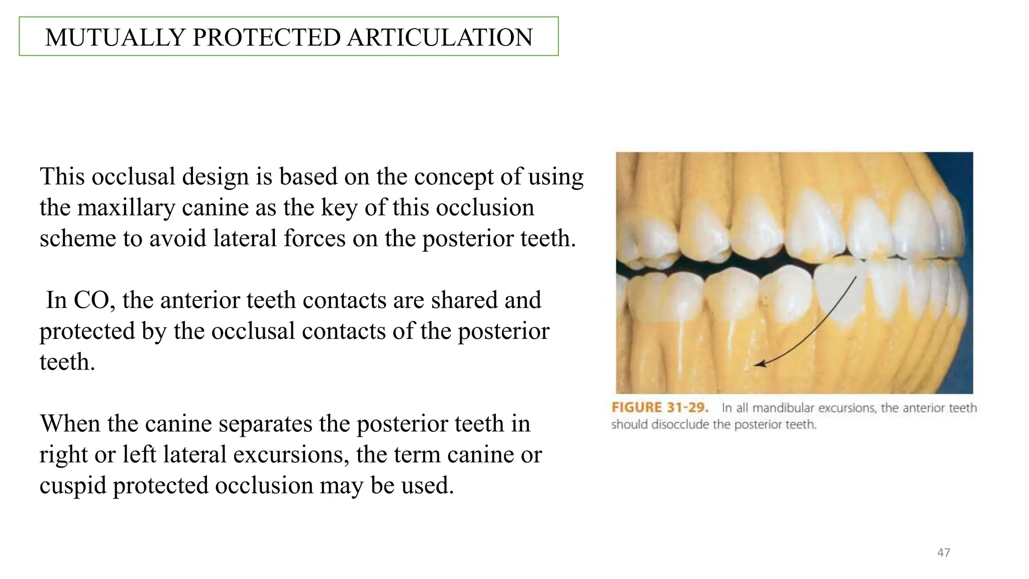 occlusion in implantology.pptx