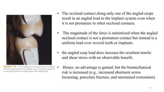 occlusion in implantology.pptx | Dental Health | Diseases and Conditions