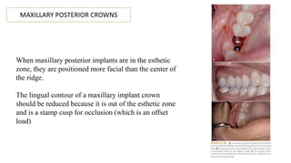 occlusion in implantology.pptx