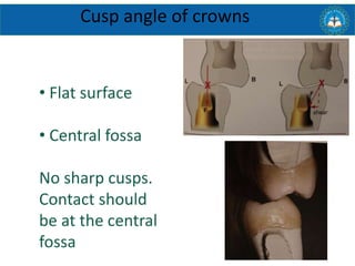 implant occlusion inside periodontology.ppt | Dental Health | Diseases ...