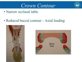 implant occlusion inside periodontology.ppt