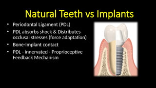 Implant occlusion necessary in implant dentistry | PPTX