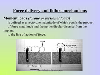 Implant occlusion and failures /certified fixed orthodontic courses by ...