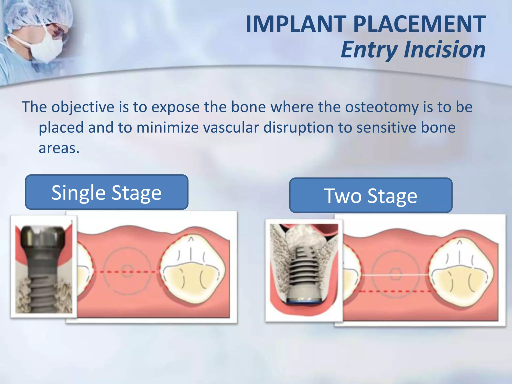 Implant placement | PPTX