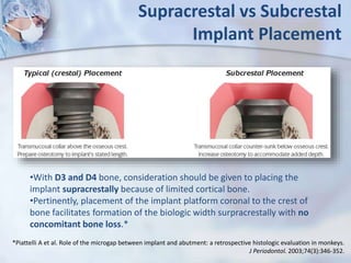 Implant placement | PPTX
