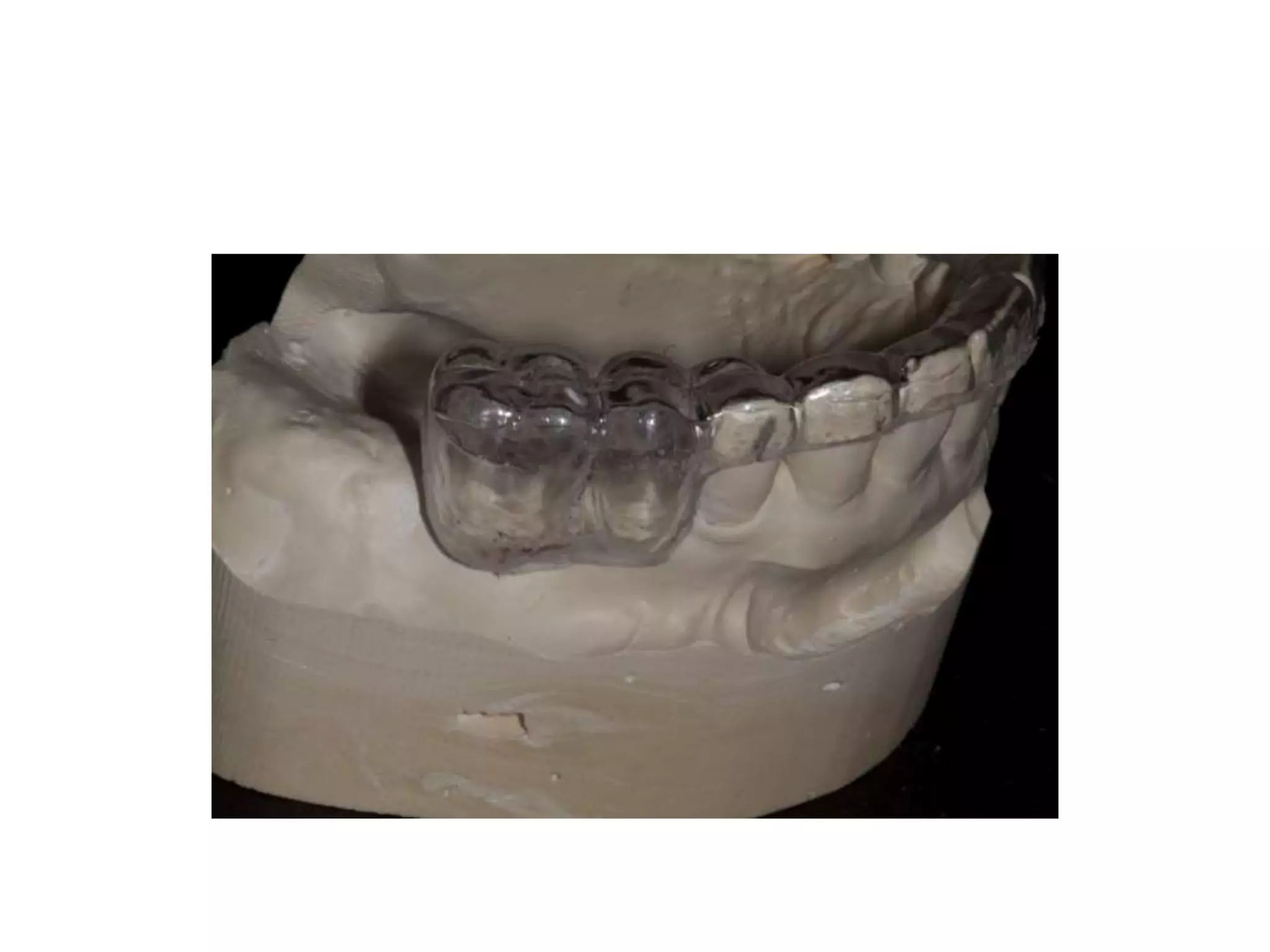 Implant placement protocol | PPTX