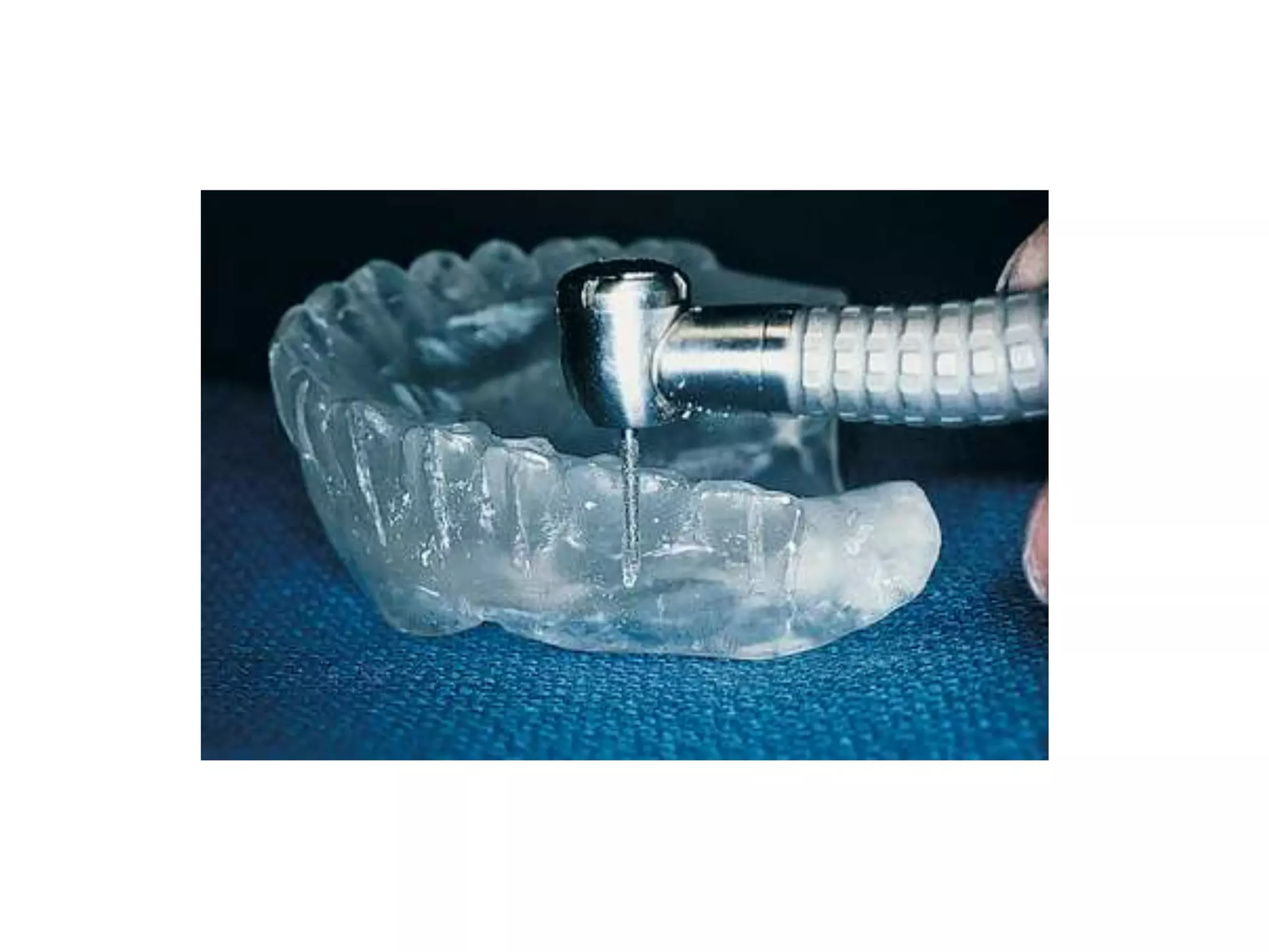 Implant placement protocol | PPTX