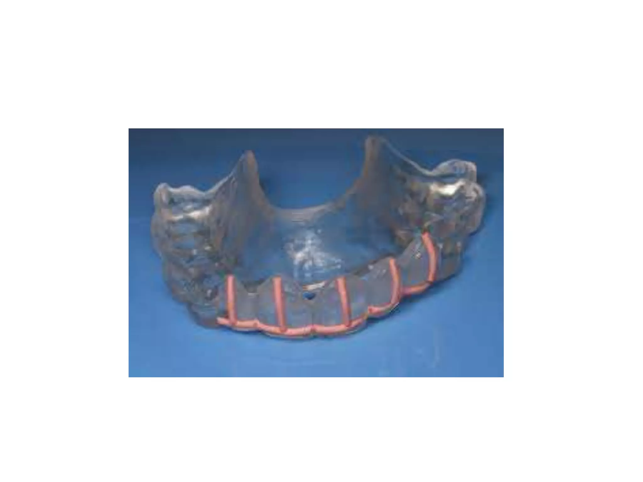 Implant placement protocol | PPTX
