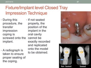 Implant prosthetic dentistry | PPTX