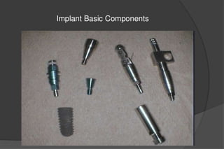 Implant prosthodontics | PDF