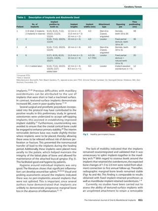 Implant Protocol For Maxillary Dentures | PDF
