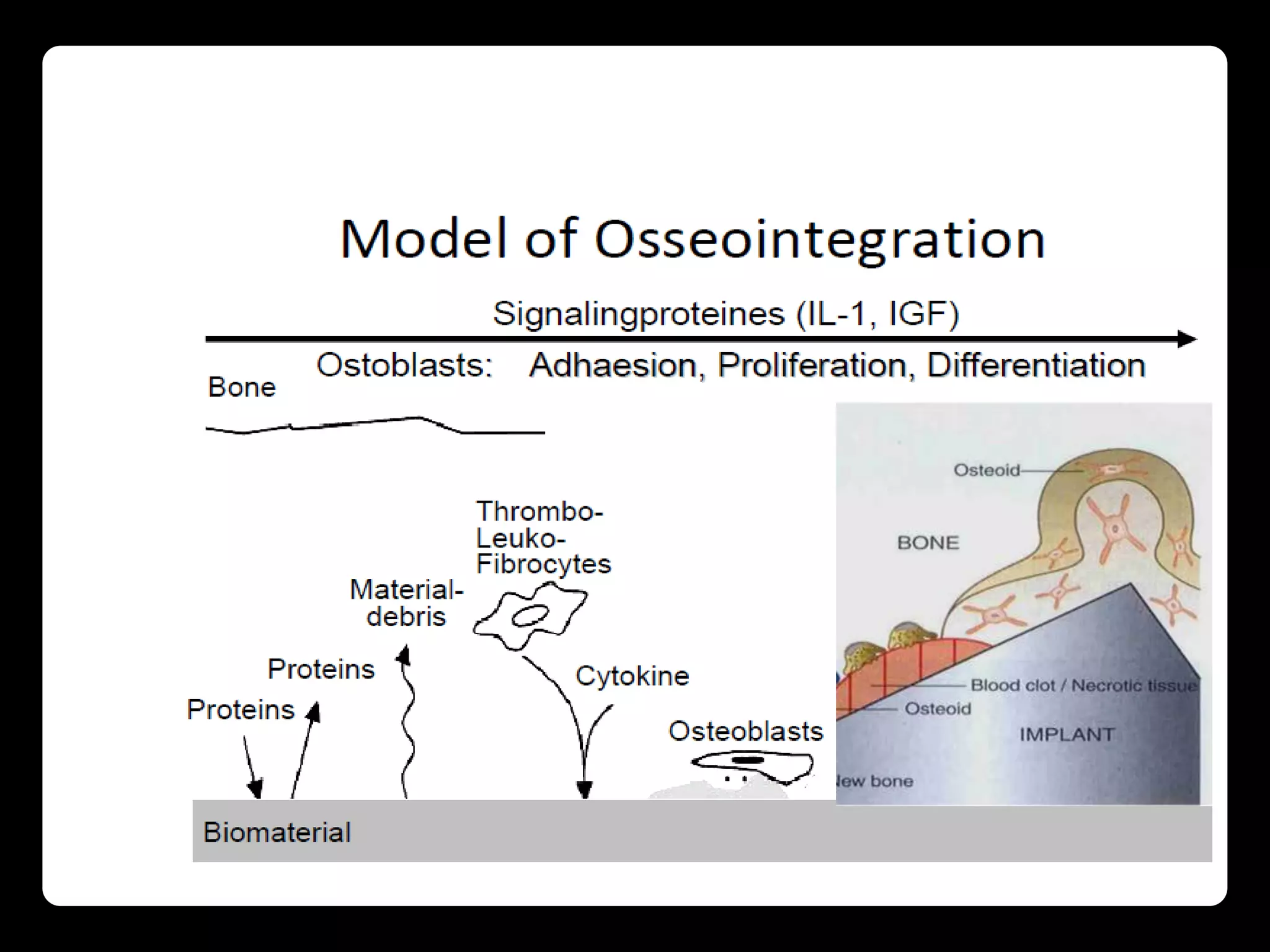 Implant quality scale ; osseointegration, success criteria and basic ...