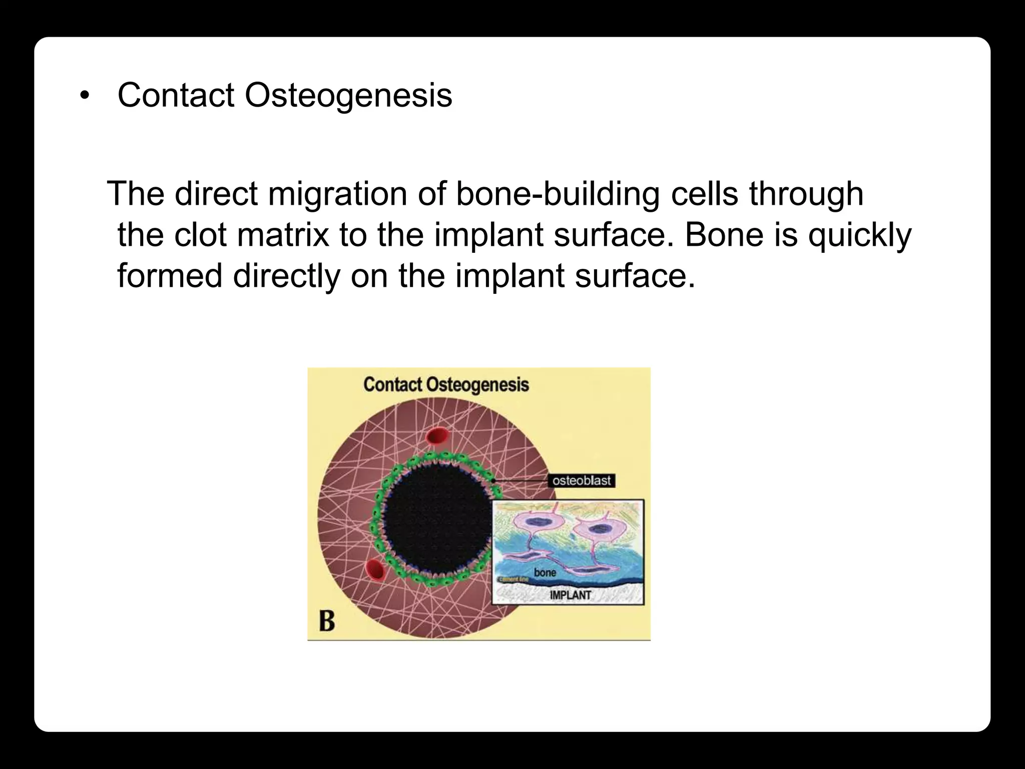 Implant quality scale ; osseointegration, success criteria and basic ...