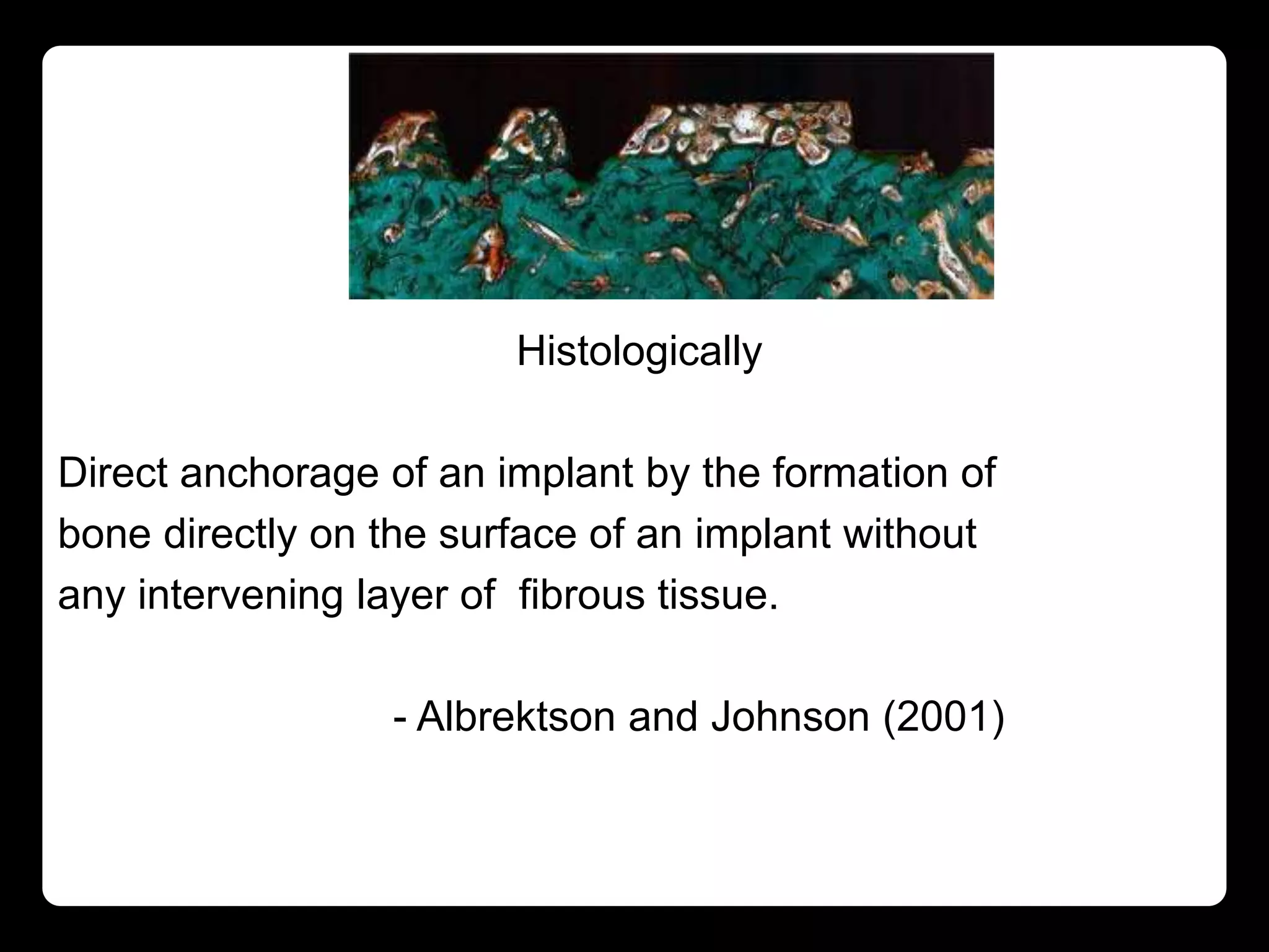 Implant quality scale ; osseointegration, success criteria and basic ...