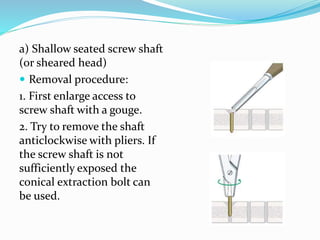 Implant removal | PPTX