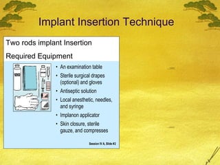 Implants.ppt3